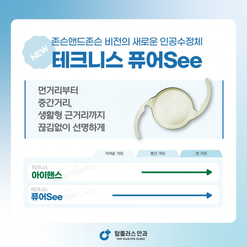 주목받는 백내장렌즈 ‘퓨어씨(Pure see)’ 광명지역 내 선도입 > 공지사항 | 탑플러스안과